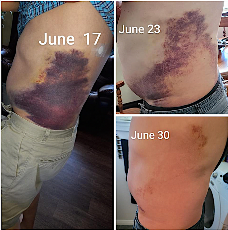 Lifewave - Dr. Shauna Young